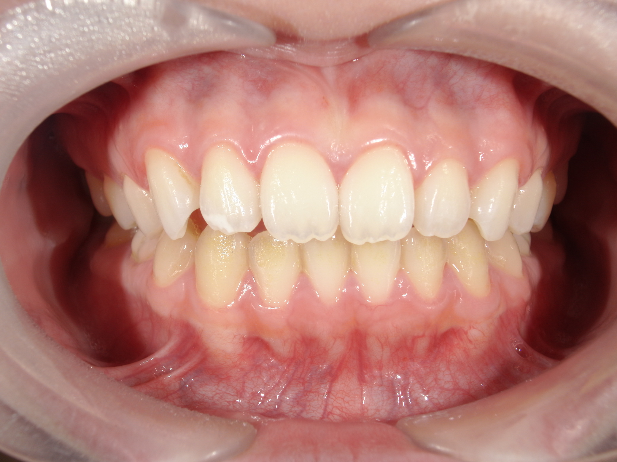 SHOFU DENTAL DIGITAL CAMERA | 門脇医科歯科医院